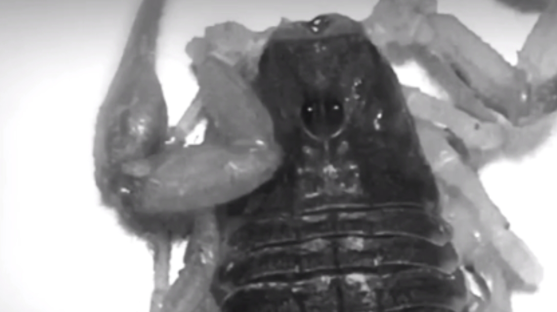 Police lead way for patient stung by scorpion - SHINE News