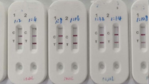 Chinese researchers develop new rapid testing kits for COVID-19 - SHINE ...