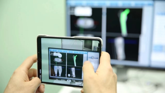 National orthopedics center set up in Shanghai to boost research and ...