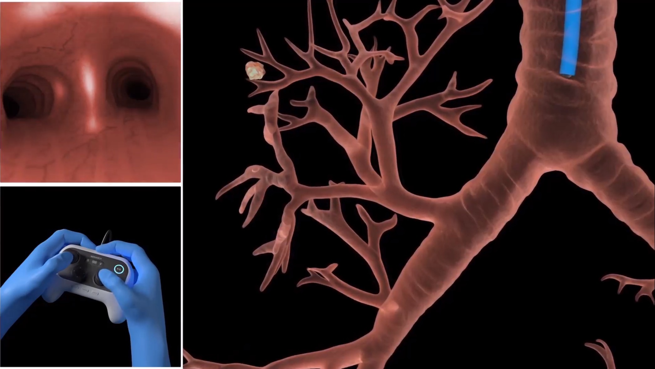 [China Tech] Robotics-assisted devices are boosting clinical practice ...