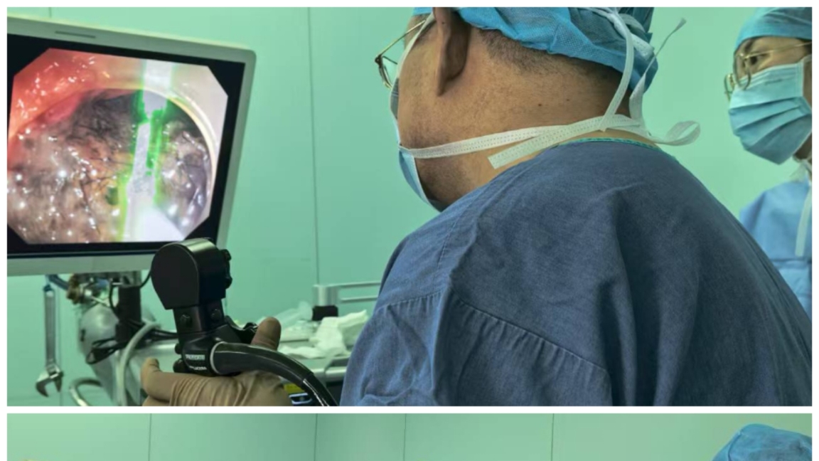 Hairball from Rapunzel Syndrome Removed via Endoscopy at Shanghai Hospital